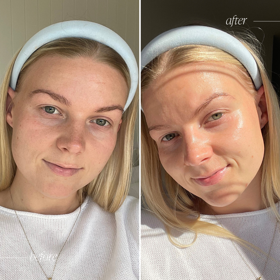 The Clean Skin Edit - Limited Edition Skincare Bundle for Luminous ...