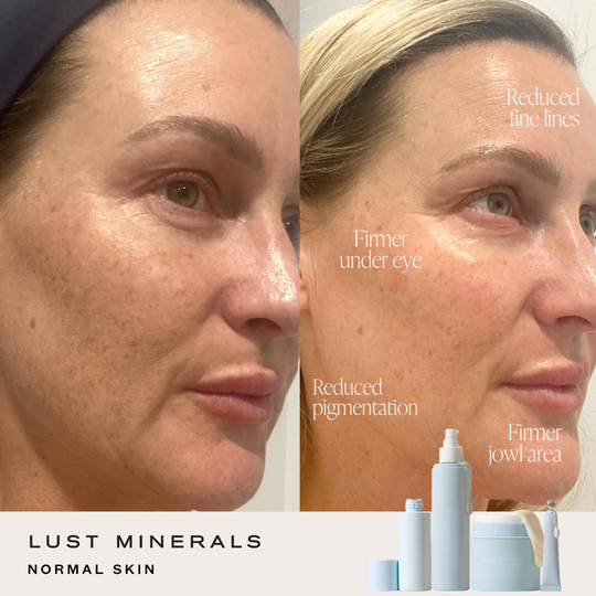 Skincare Bundles - Up to 60% off best selling bundles with results in ...